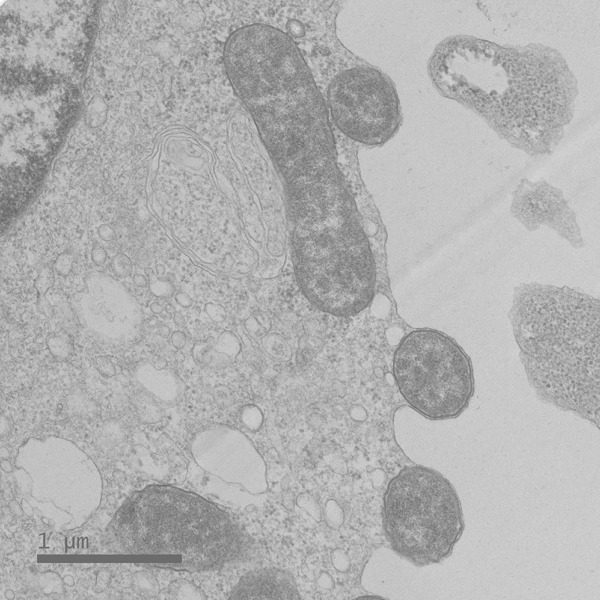 RESEARCH – SALJE LAB